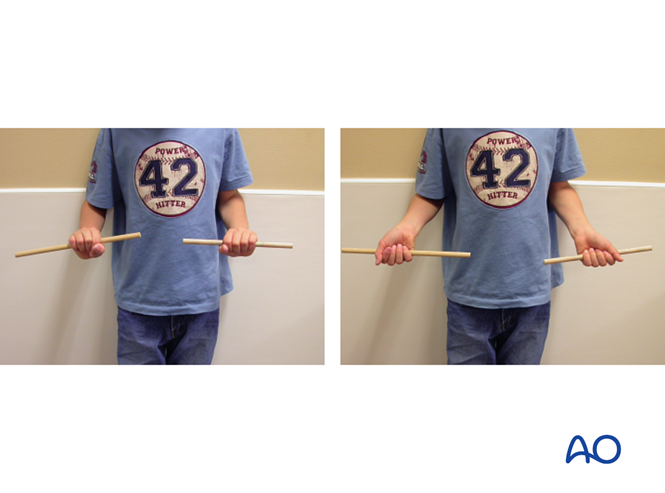 Fracture instability and malalignment