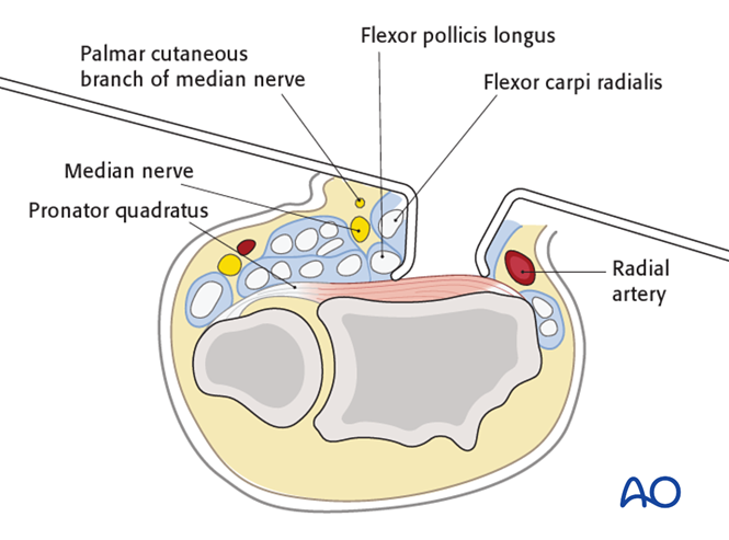 Volar (anterior) approach to the pediatric distal radius