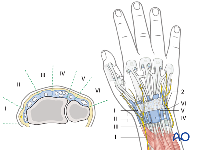 Closed reduction; long arm cast for Metaphyseal, simple complete, both ...