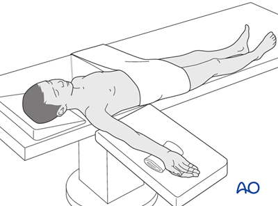 Supine positioning