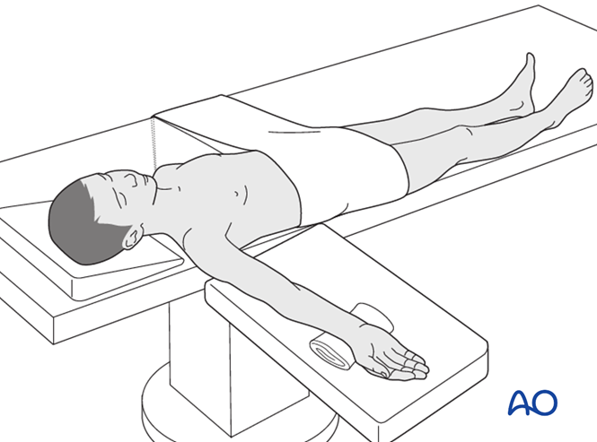 Supine positioning
