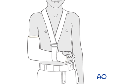 Closed reduction; long arm cast for Simple epiphysiolysis, Salter ...