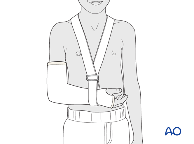 Closed reduction; long arm cast for Simple epiphysiolysis, Salter ...