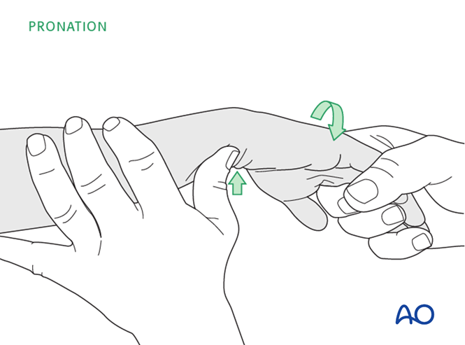 Closed reduction; long arm cast for Simple epiphysiolysis with ...