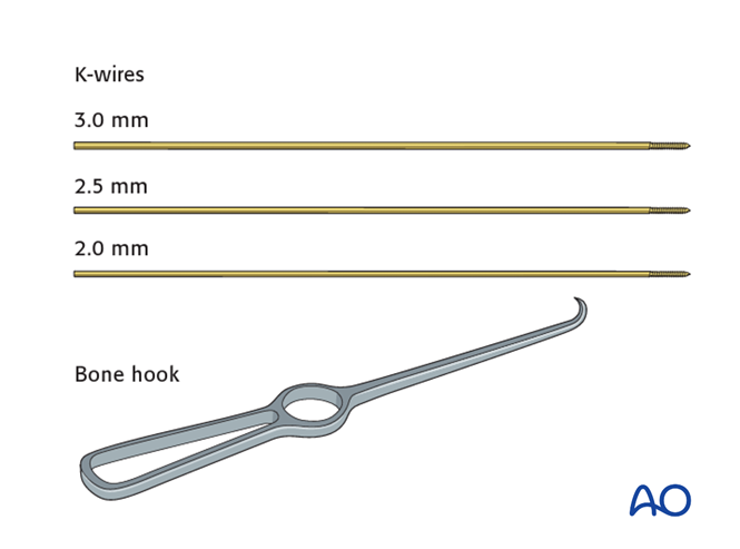 Open reduction, K-wire fixation for Traumatic epiphysiolysis, SH I