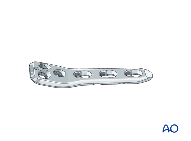 Open reduction, pediatric hip locking plate for Complete ...