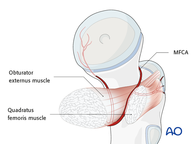 Open vs closed reduction