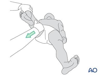 Closed reduction maneuvers