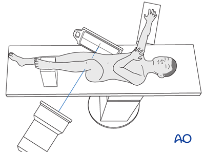 Radiological assessment