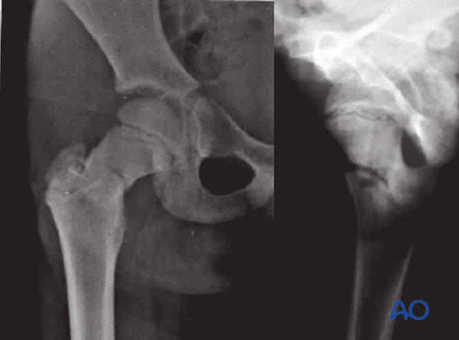 Radiological assessment