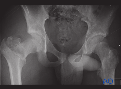 Radiological assessment