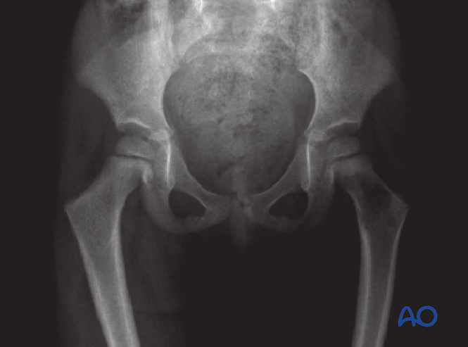 Radiological assessment