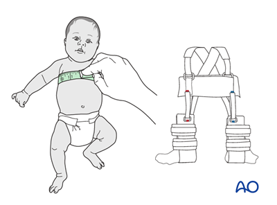 Pavlik harness for Complete transverse, simple