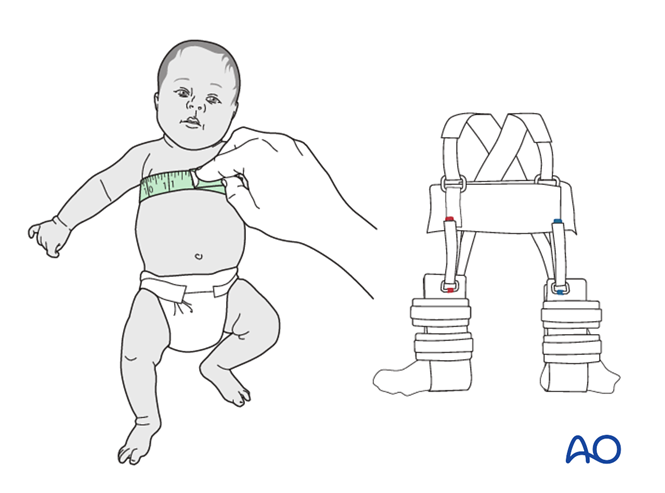 Pavlik harness for Complete transverse, simple