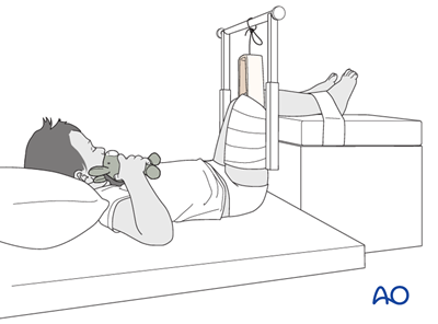 Traction for Complete transverse, simple