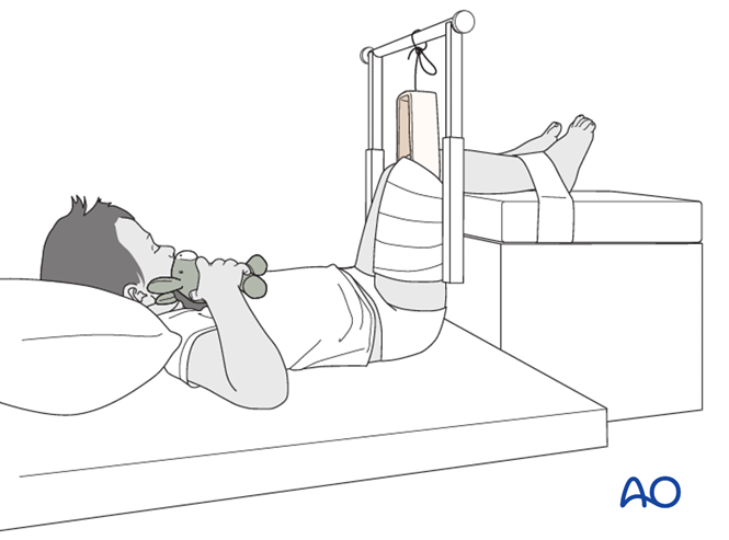 Traction for Complete transverse, simple