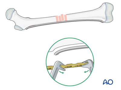 MIPO for Complete transverse, simple