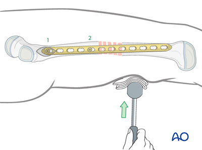 MIPO for Complete transverse, simple