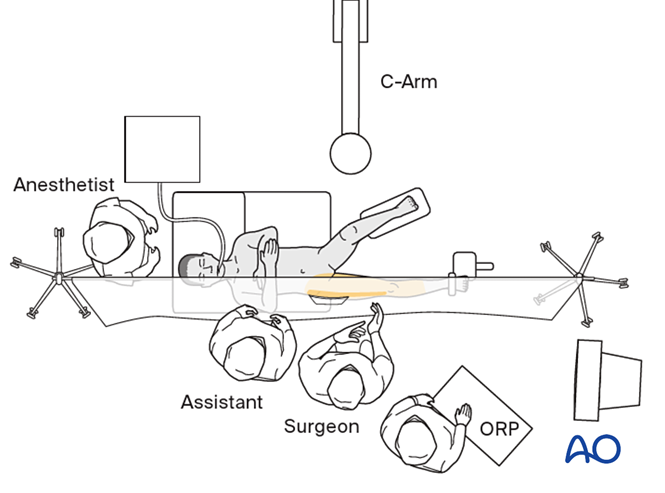 Patient preparation in supine position