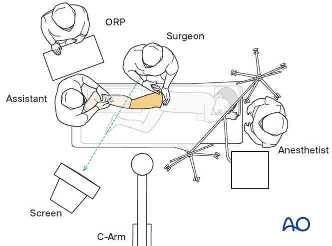 Patient preparation in lateral position