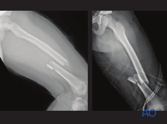 Radiological evaluation