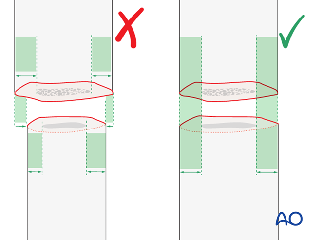 Assessment of rotation
