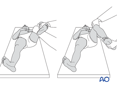 Assessment of rotation