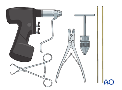 Closed reduction; K-wire fixation followed by casting for ...