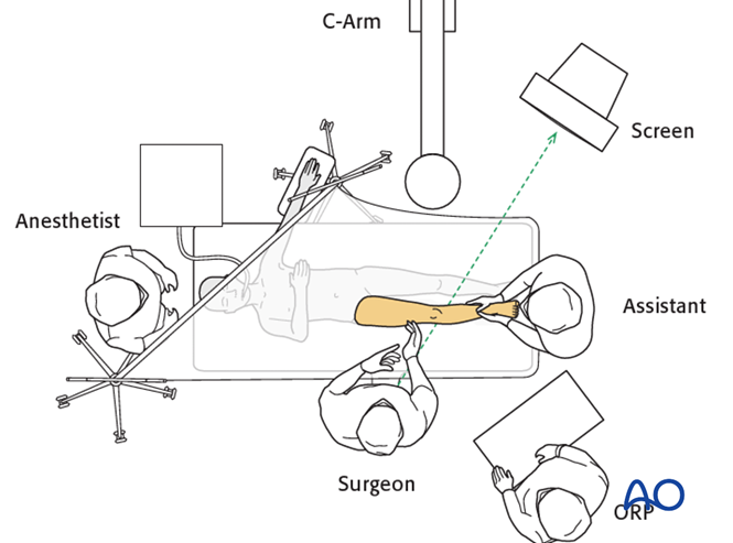 Patient preparation in supine position