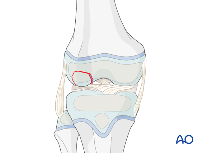 Anatomy of the distal femur