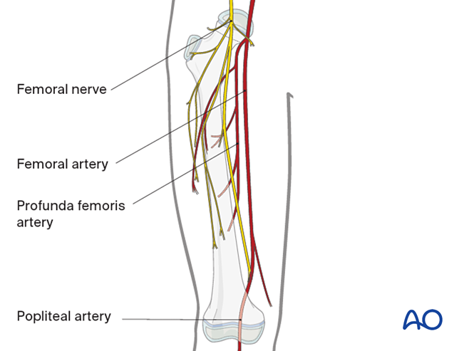 Safe zones for pin placement in the pediatric thigh and leg
