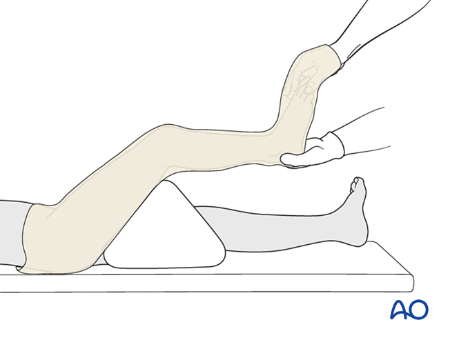 Long leg cast