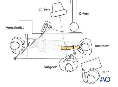 Patient preparation in supine position