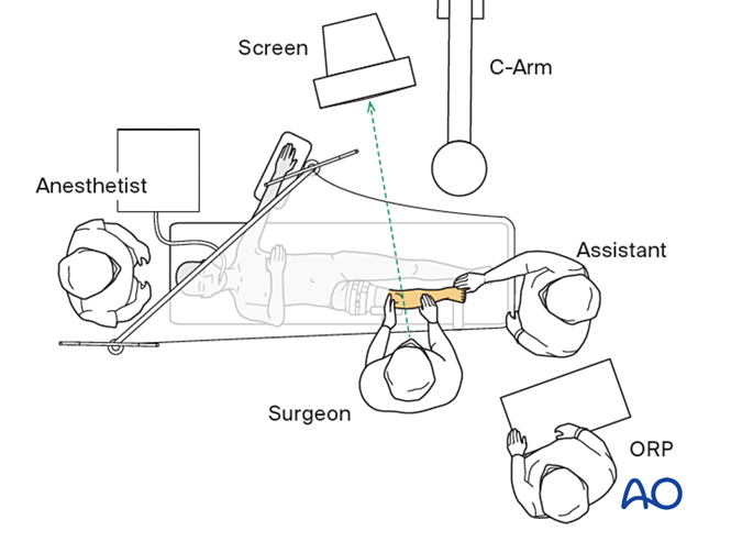 Patient preparation in supine position for arthroscopy