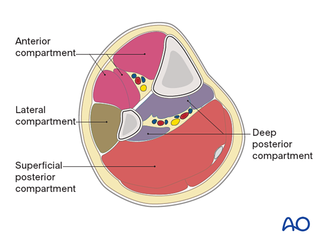Approach to the anteromedial tibial surface