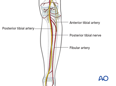 Safe zones for pin placement in the pediatric tibia