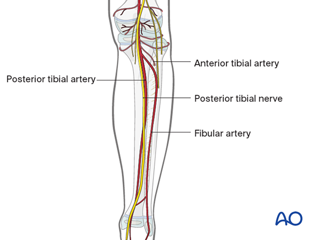 Safe zones for pin placement in the pediatric tibia