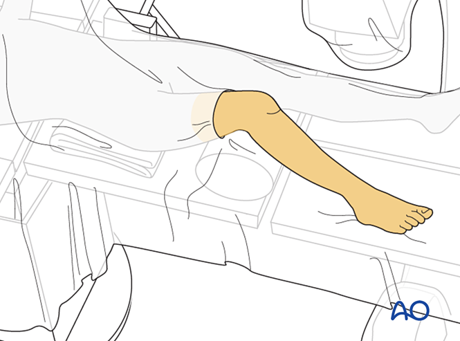 Patient preparation in supine position