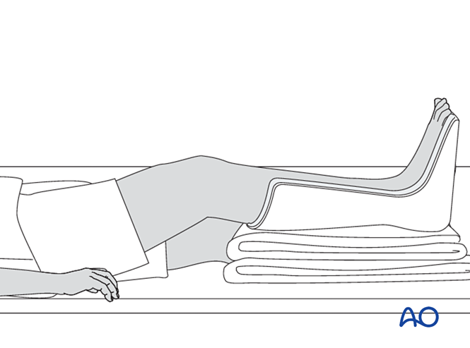 Compartment syndrome (lower limb)