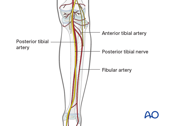 Safe zones for pin placement in the pediatric leg