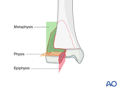 Complex epi-/metaphyseal fractures of the distal tibia (triplane)