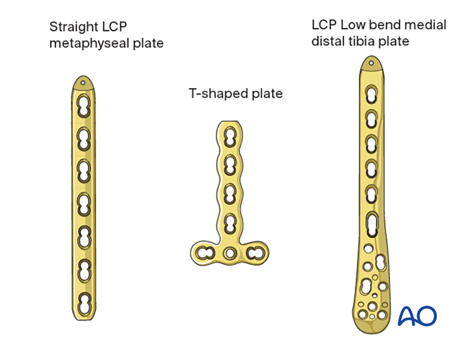MIO bridge plating for Simple complete fracture of the distal tibial ...