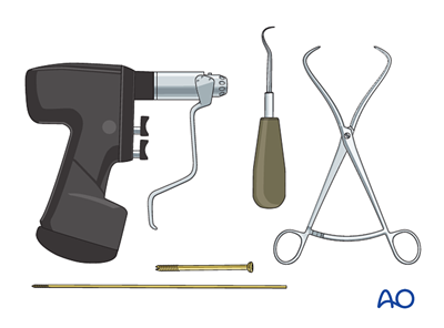 Open reduction; screw fixation for Complex epi-/metaphyseal fractures ...
