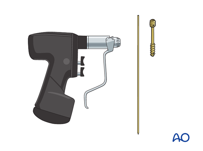 Open reduction; screw fixation for Avulsion fractures of the medial ...