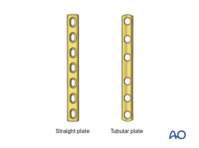 Open reduction; plate fixation for Epiphysiolysis (Salter-Harris I and ...