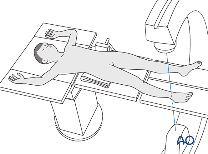 Patient preparation in supine position