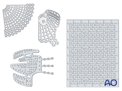 Orbital reconstruction for Orbital floor fracture