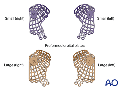 Orbital reconstruction for Orbital floor fracture