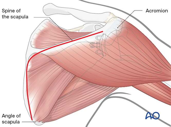 Posterior approach to the scapular body