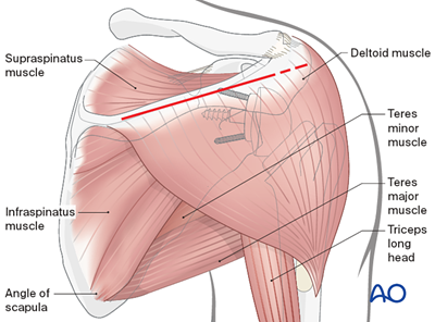 All approaches to the shoulder
